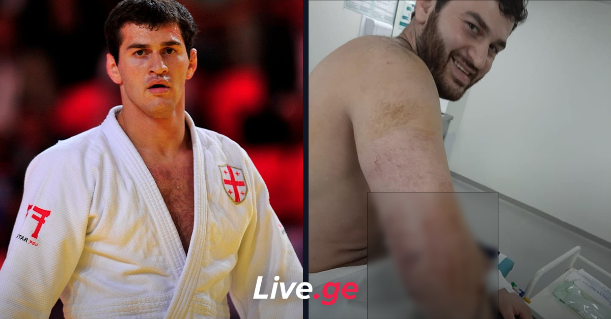 ავთანდილ ჭრიკიშვილმა ოპერაცია გაიკეთა - ხელში მგრძნობელობა მხოლოდ 13% ჰქონდა | belive.ge
